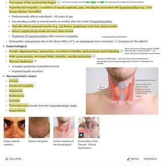 Hyperthyroidism and thyrotoxicosis - AMBOSS.pdf