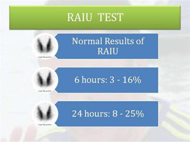 HYPERTHYROIDISM PART-1 BY DR BASHIR ASSOCIATE PROFESSOR MEDICINE SOPO…