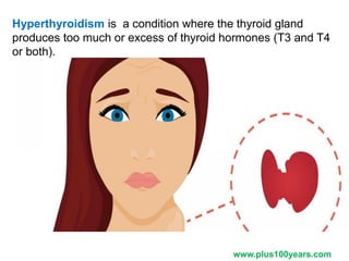 Hyperthyroidism Diet - Foods to Eat and Foods to Avoid | PDF