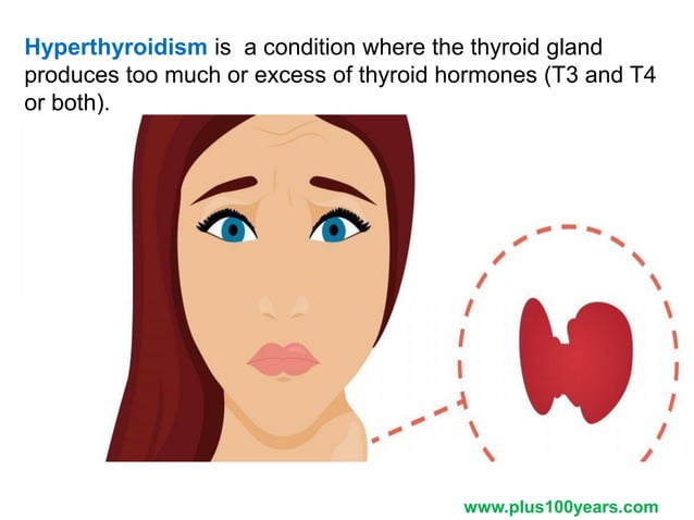 Hyperthyroidism Diet - Foods to Eat and Foods to Avoid | PDF | Thyroid ...