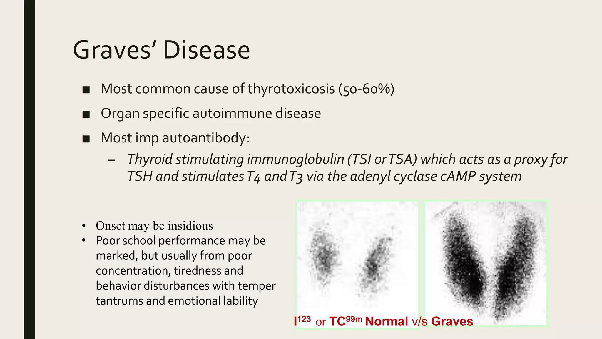 Hyperthyroidism in children | PPTX
