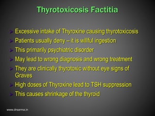 Hyperthyroidism management | PPT