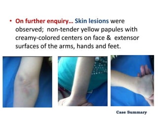 Hypertriglyceridemia in newly diagnosed d.m | PPT