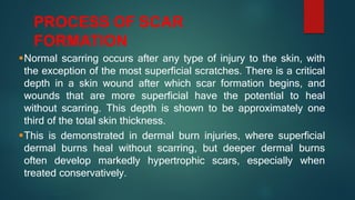 hyper trohpic scar MANAGEMENT FOR --pdf.pdf