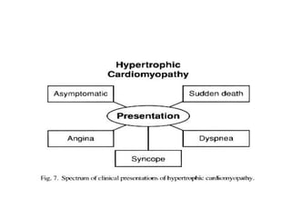 Hypertrophic cardiomyopathy | PPT