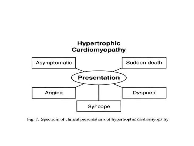 Hypertrophic cardiomyopathy | PPT