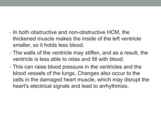 Hypertrophic Cardiomyopathy | PPTX