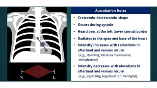 HYPERTROPHIC CARDIOMYOPATHY (HOCM): A disease of Heart | PPT