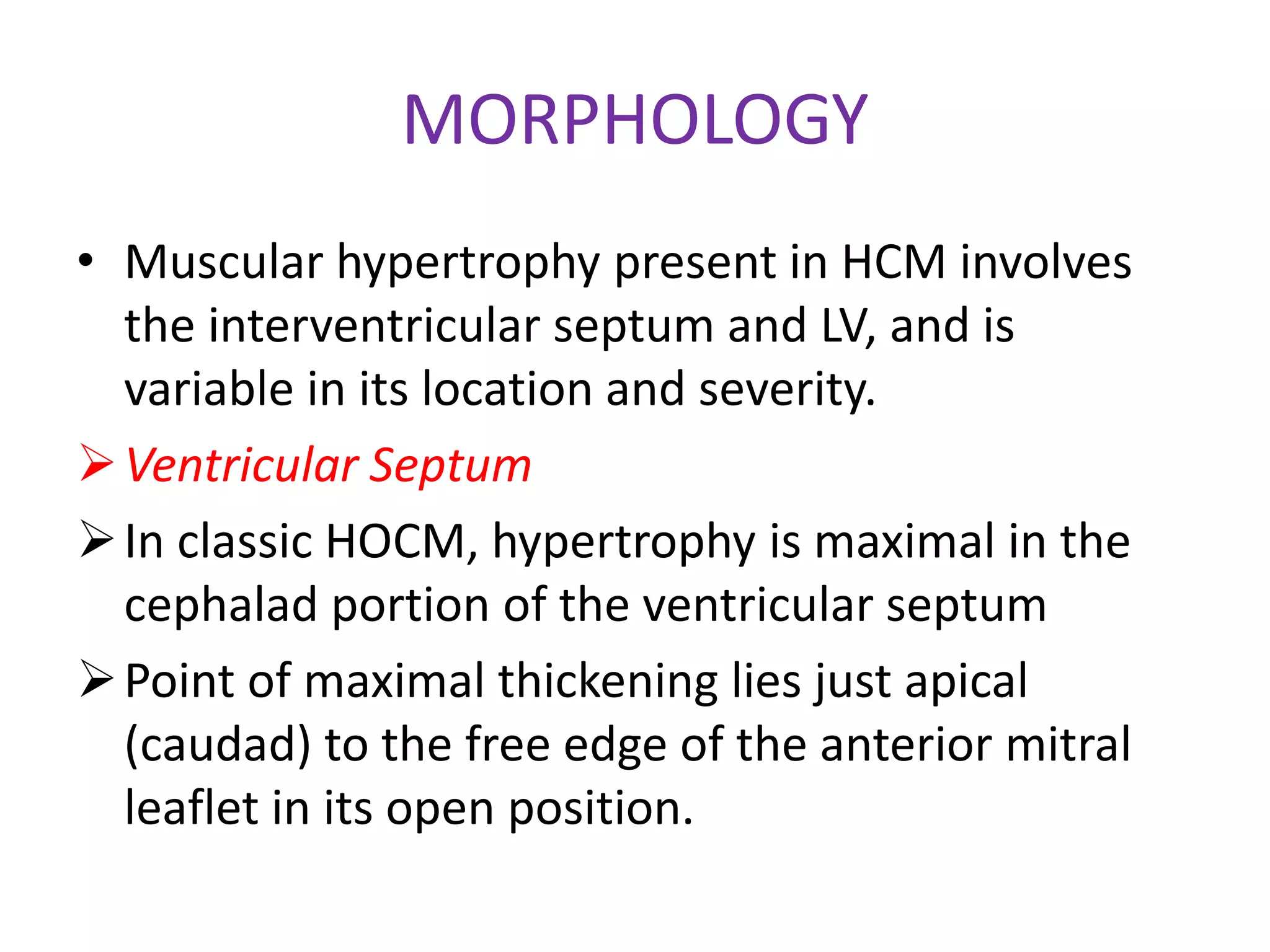 Hypertrophic obstructive cardiomyopathy | PPTX