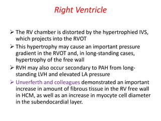 Hypertrophic obstructive cardiomyopathy | PPTX