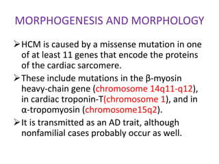 Hypertrophic obstructive cardiomyopathy | PPTX