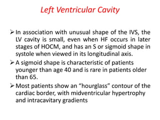 Hypertrophic obstructive cardiomyopathy | PPTX