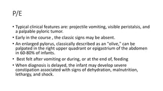 Hypertrophic pyloric stenosis.pptx
