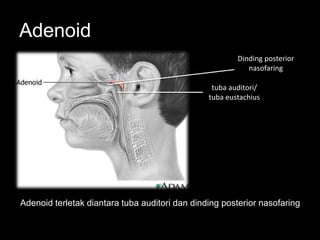 Hypertrophy of Adenoid | PPSX