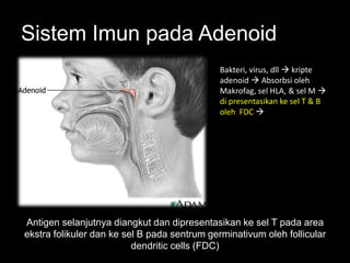 Hypertrophy of Adenoid | PPSX
