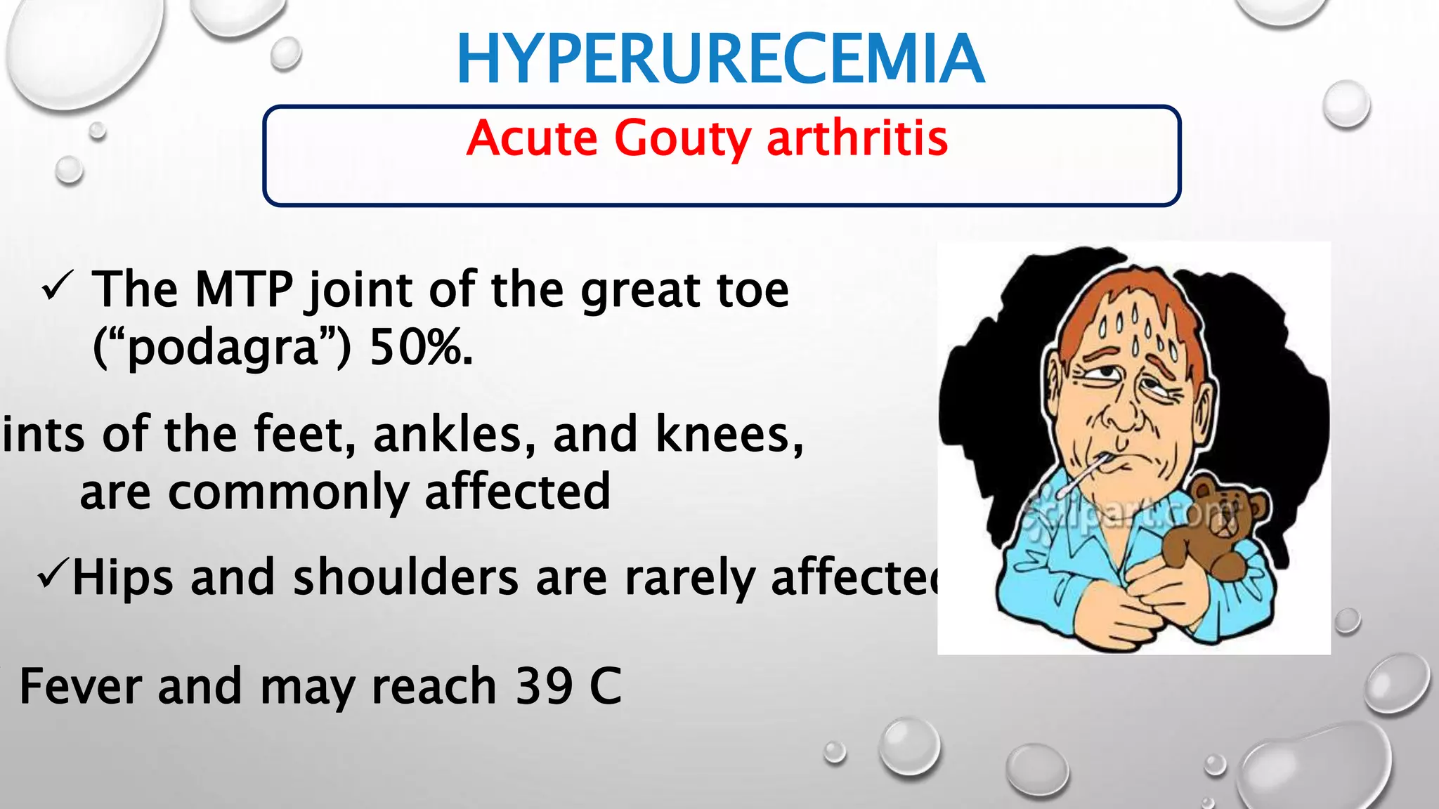 Hyperuricemia | PPTX