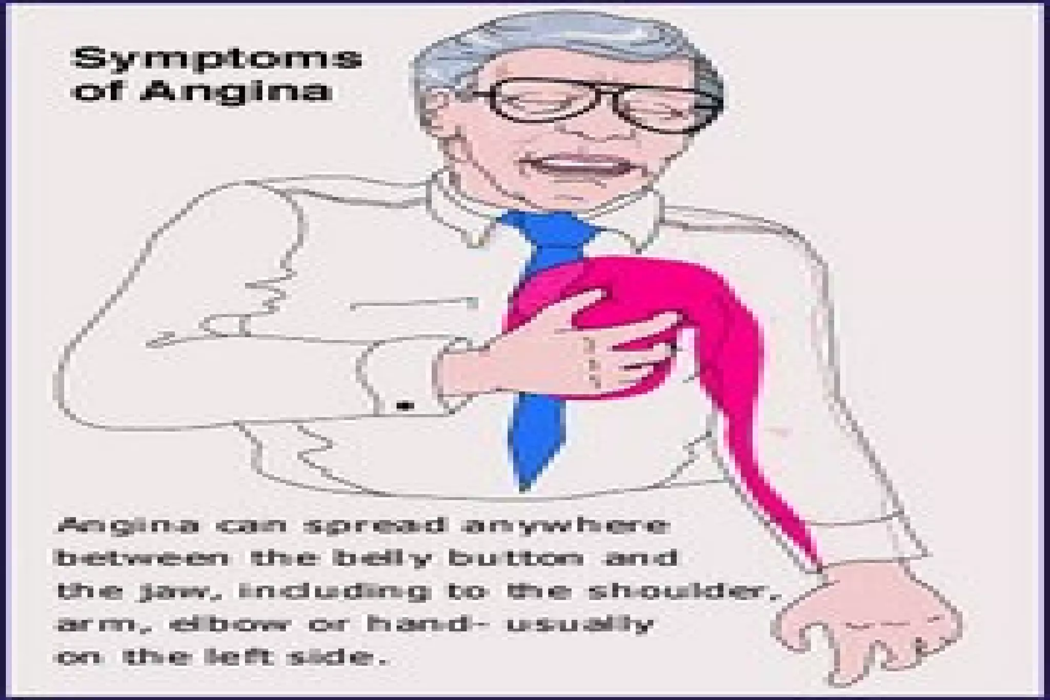 Hyperventilation syndrome. | PPT