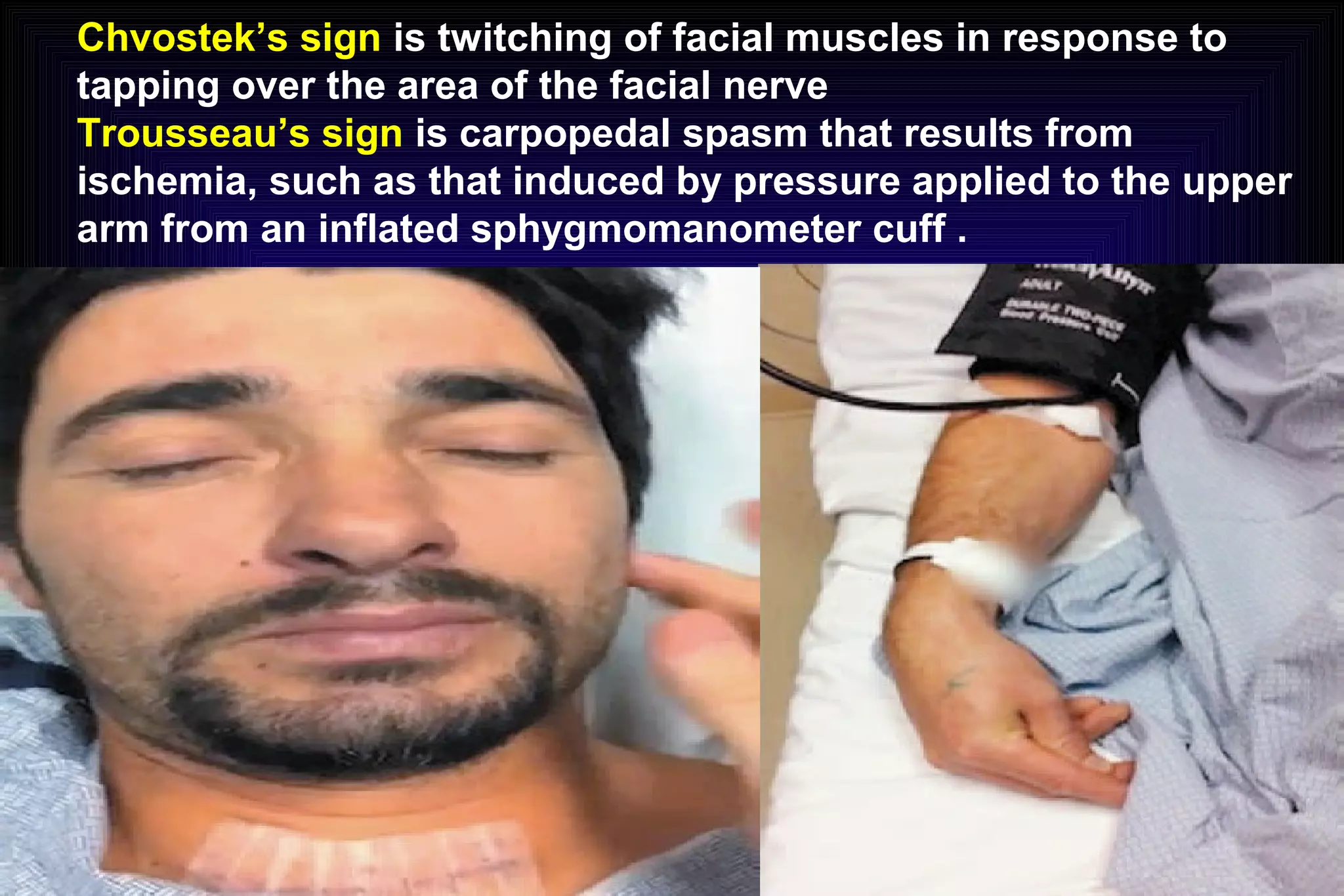 Hyperventilation syndrome. | PPT