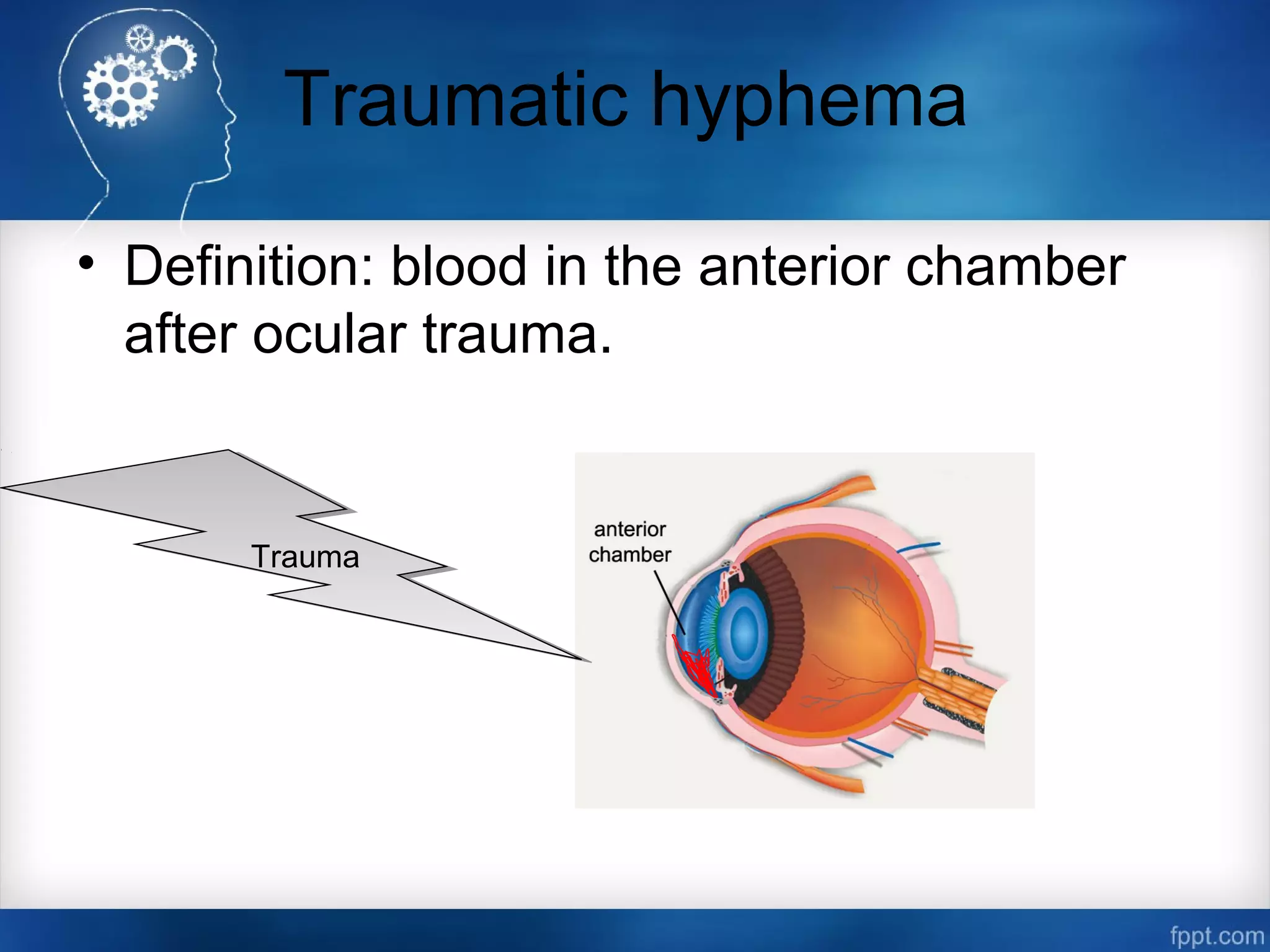 case of a blunt trauma to the left eye causing traumatic hyphema | PPT