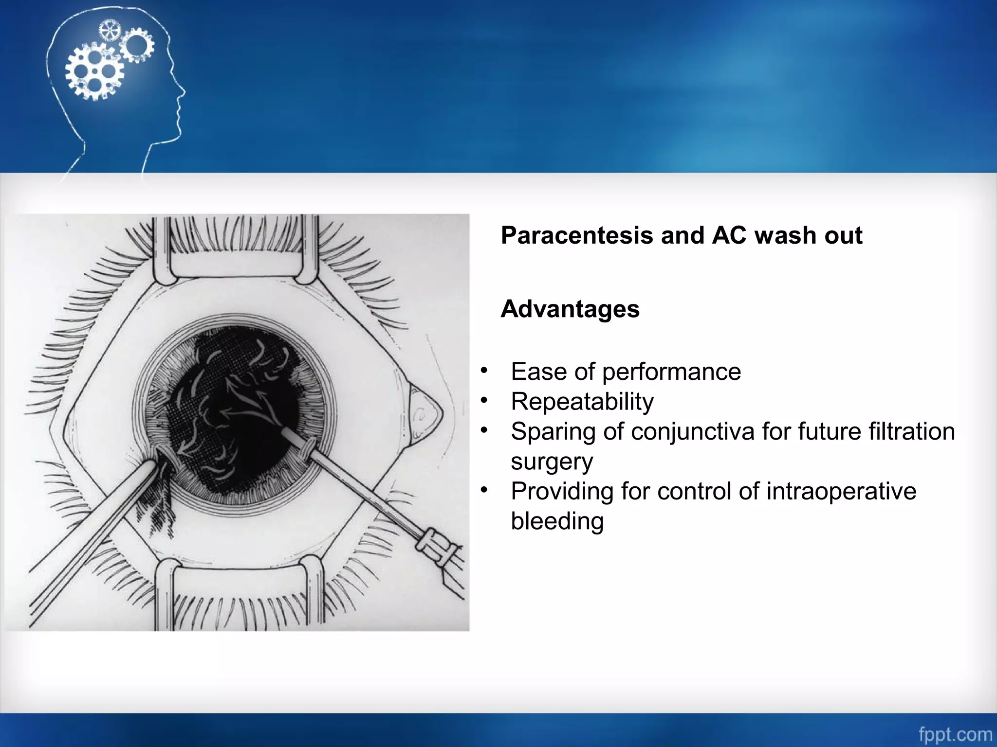 case of a blunt trauma to the left eye causing traumatic hyphema | PPT