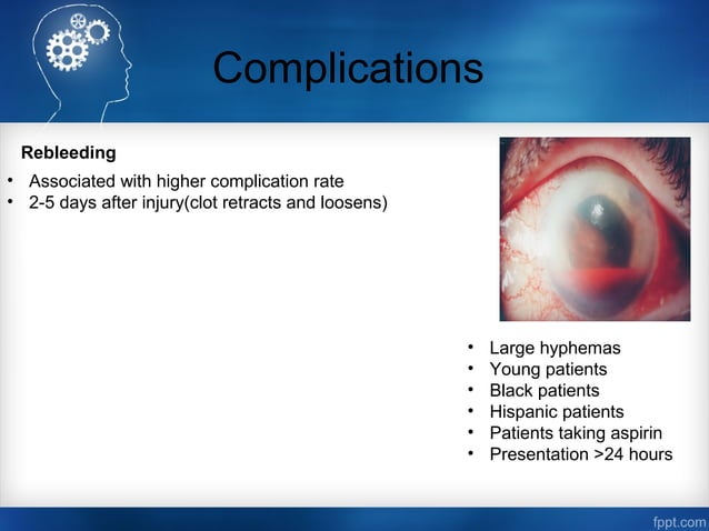 case of a blunt trauma to the left eye causing traumatic hyphema | PPT ...