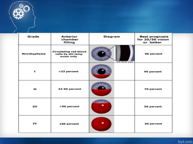 case of a blunt trauma to the left eye causing traumatic hyphema | PPT ...