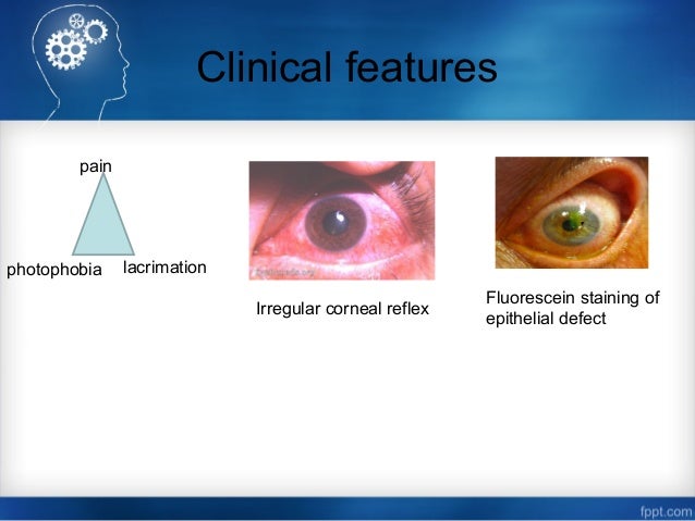 case of a blunt trauma to the left eye causing traumatic hyphema
