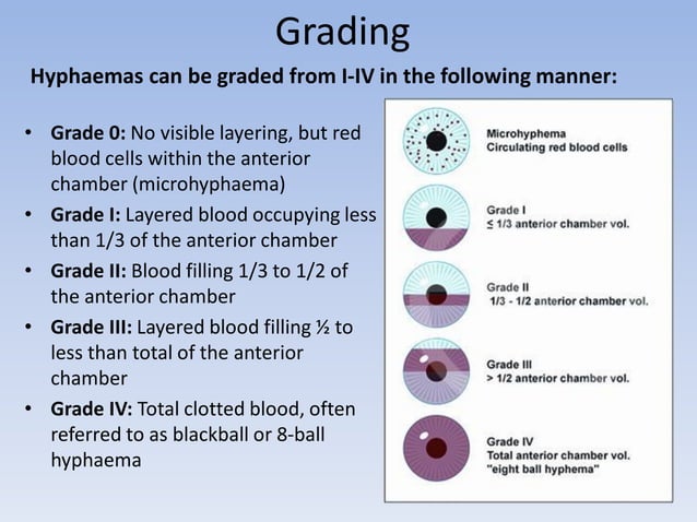 Hyphema | PDF | Eye and Vision Conditions | Diseases and Conditions