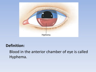Hyphema