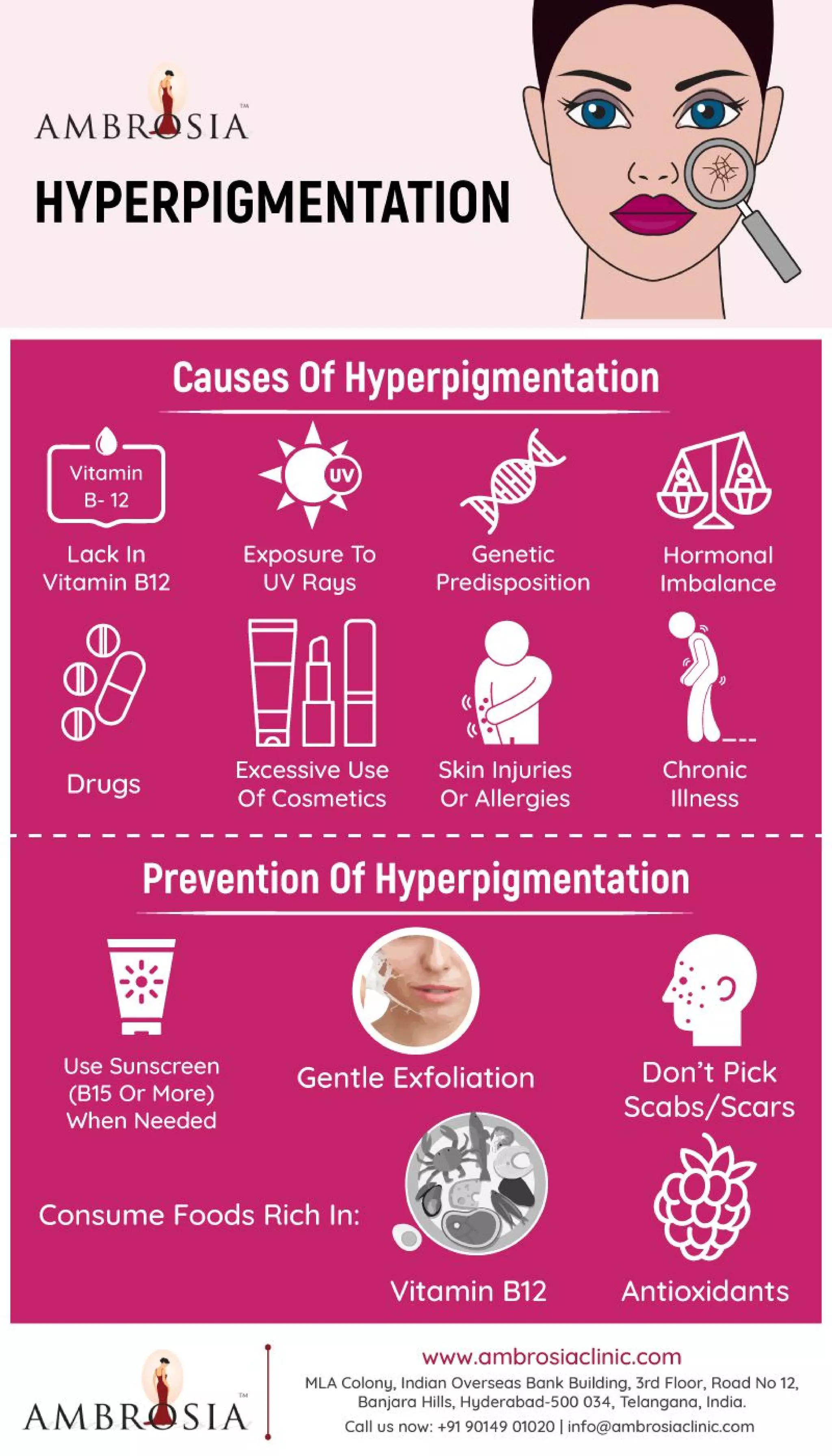 Hyperpigmentation Causes and Prevention | PDF