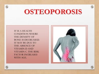 Hypokinetic disease | PPTX