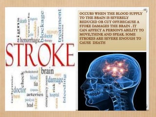 Hypokinetic disease | PPTX