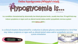 Hypoglycemia | PPTX