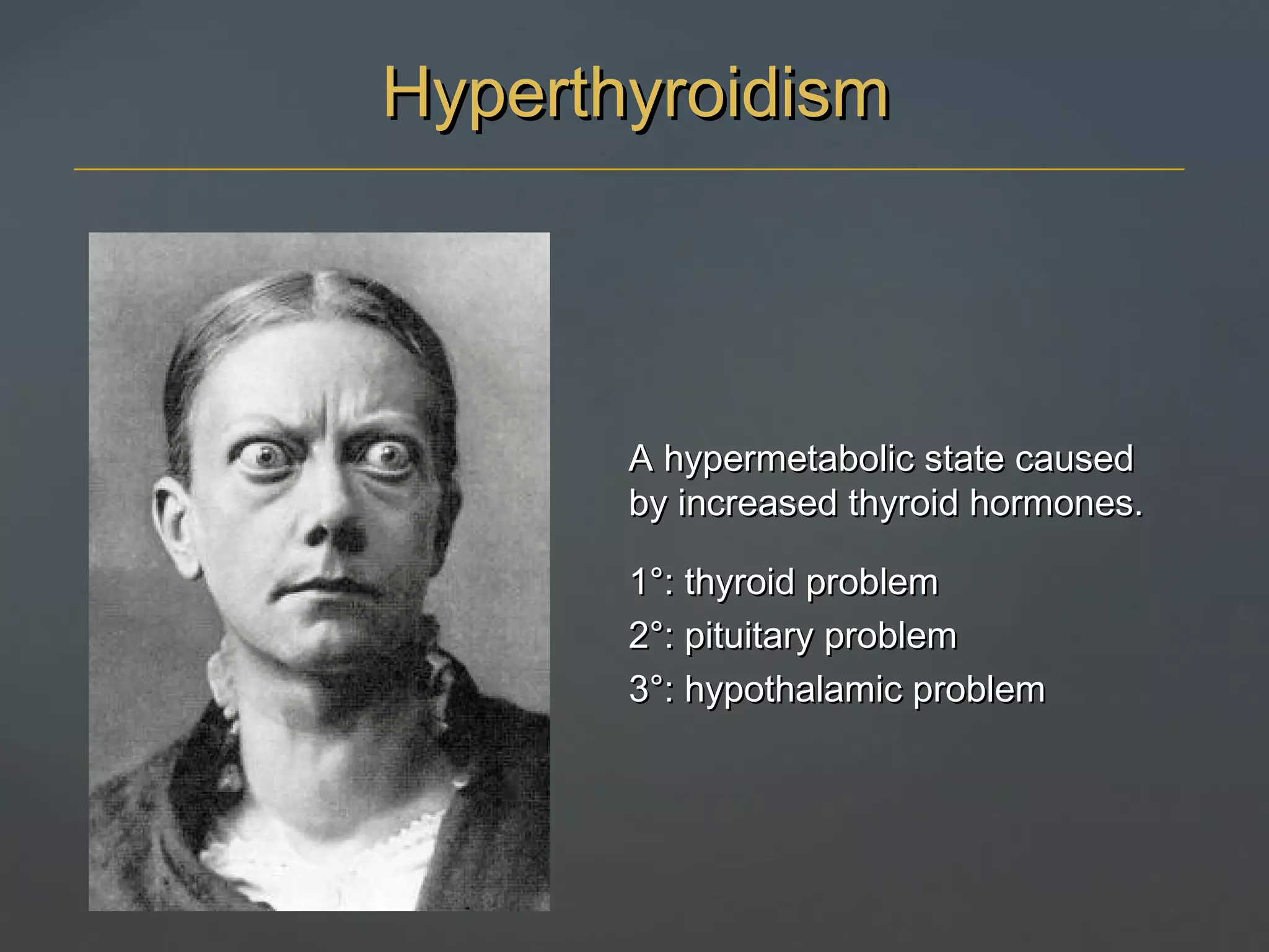 Hypo and Hyper Thyroidism | PPT
