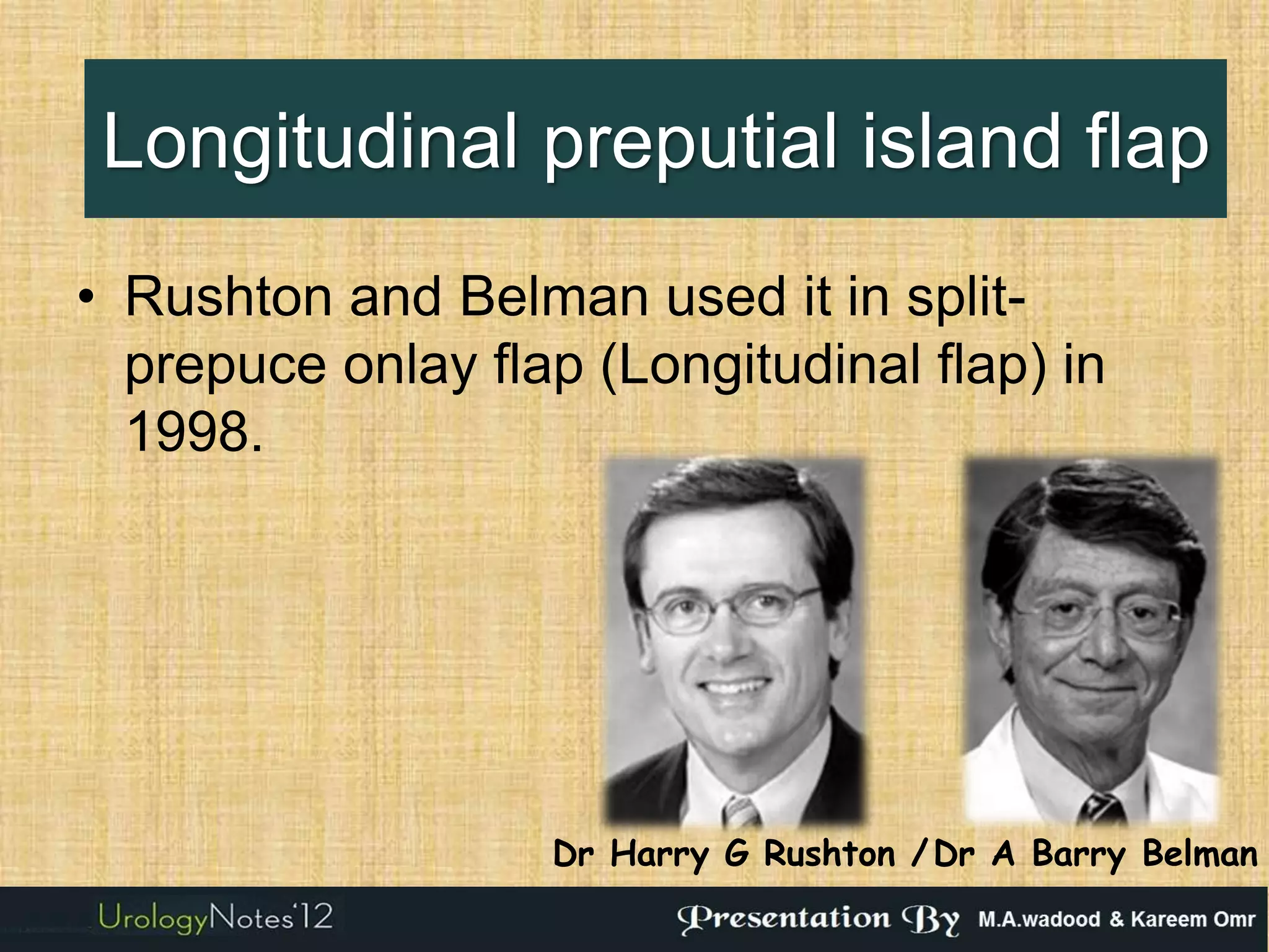Hypospadias 2 new techniques: longitudinal preputial flap & single ...
