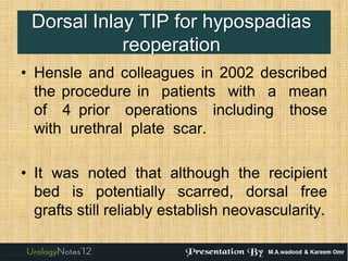 Hypospadias 2 new techniques: longitudinal preputial flap & single ...