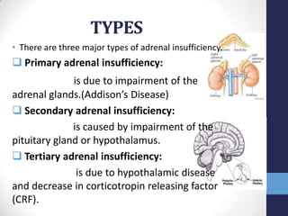 Hypoadrinalism | PPTX