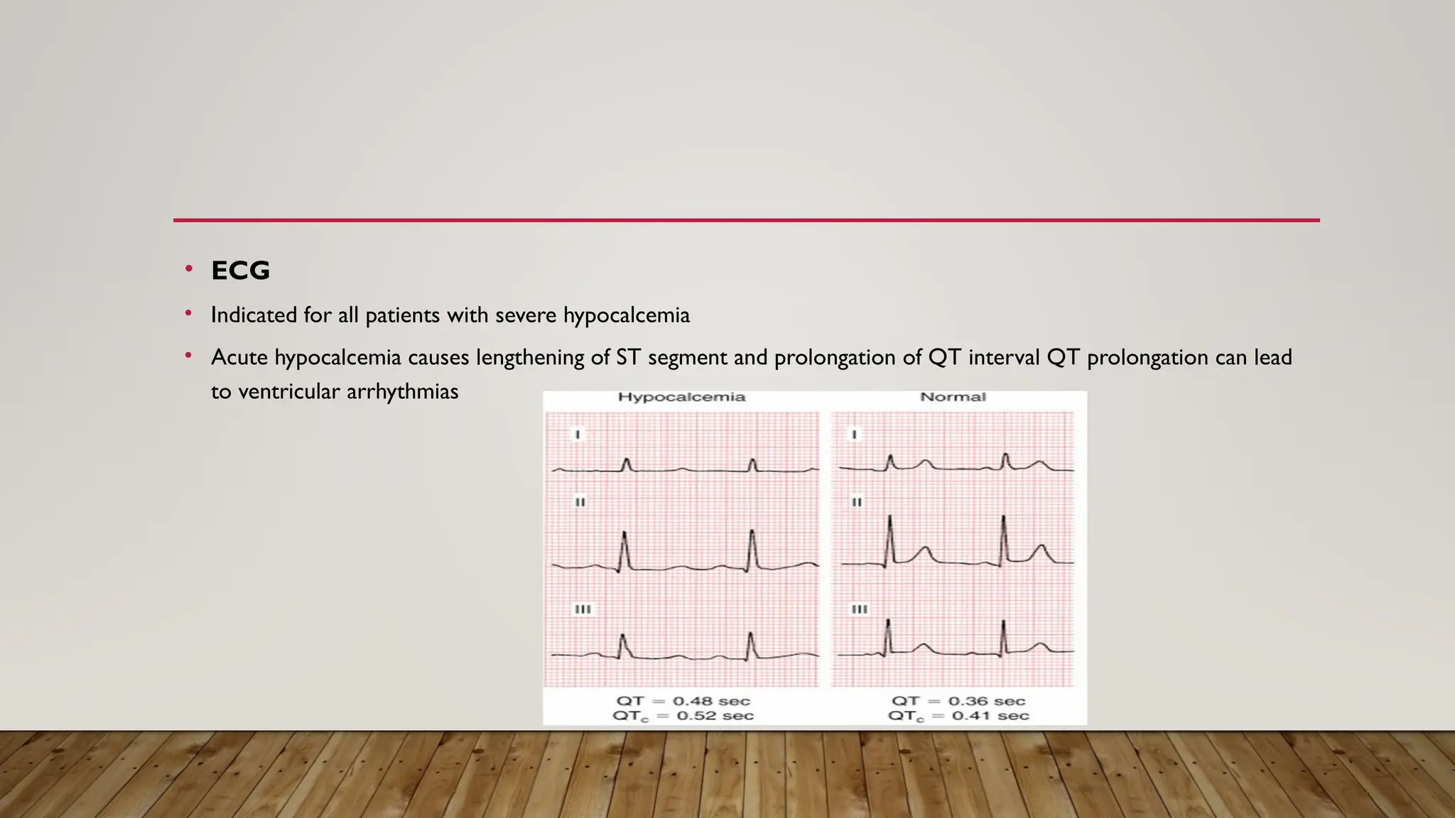 HypocalcemiaHypocalcemiaHypocalcemiaHypocalcemiaHypocalcemia.pptx