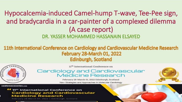 Hypocalcemia induced camel-hump t-wave, tee-pee sign, and bradycardia ...