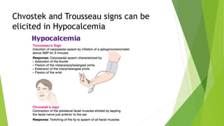 HYPOCALCEMIA AND HYPERCALCEMIA presentation.pdf | Endocrine and ...