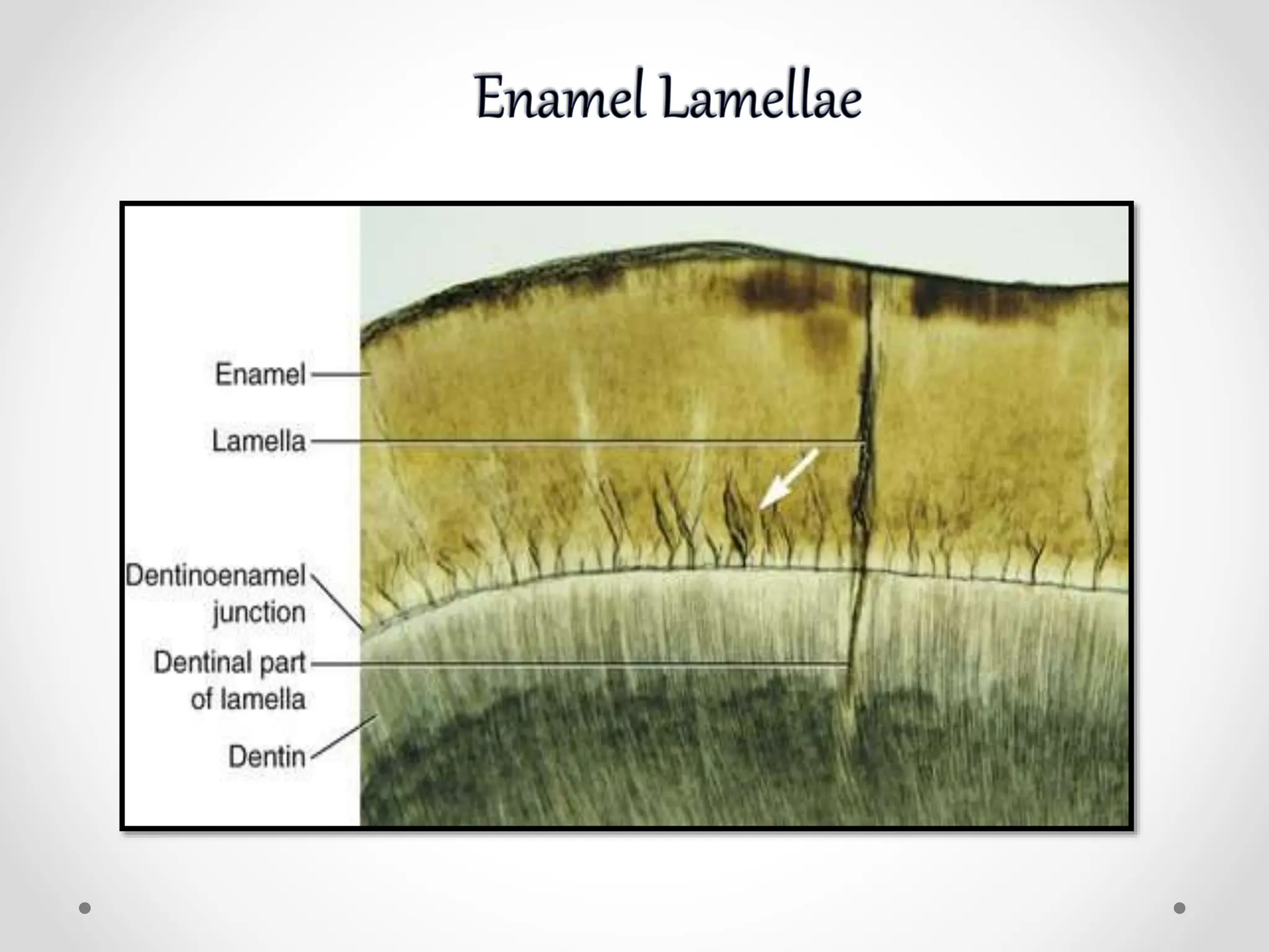 HYPOCALCIFIED STRUTURES OF ENAMEL.pptx