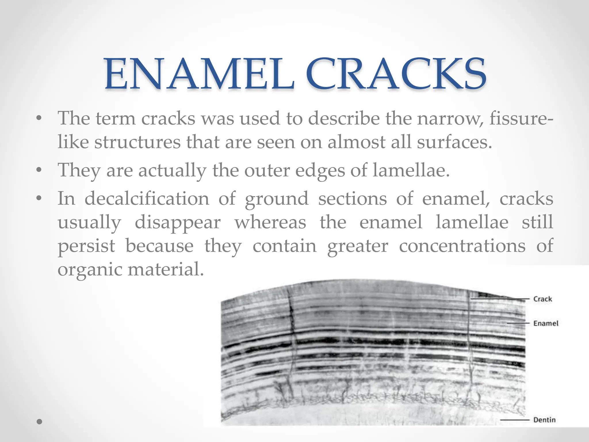 HYPOCALCIFIED STRUTURES OF ENAMEL.pptx