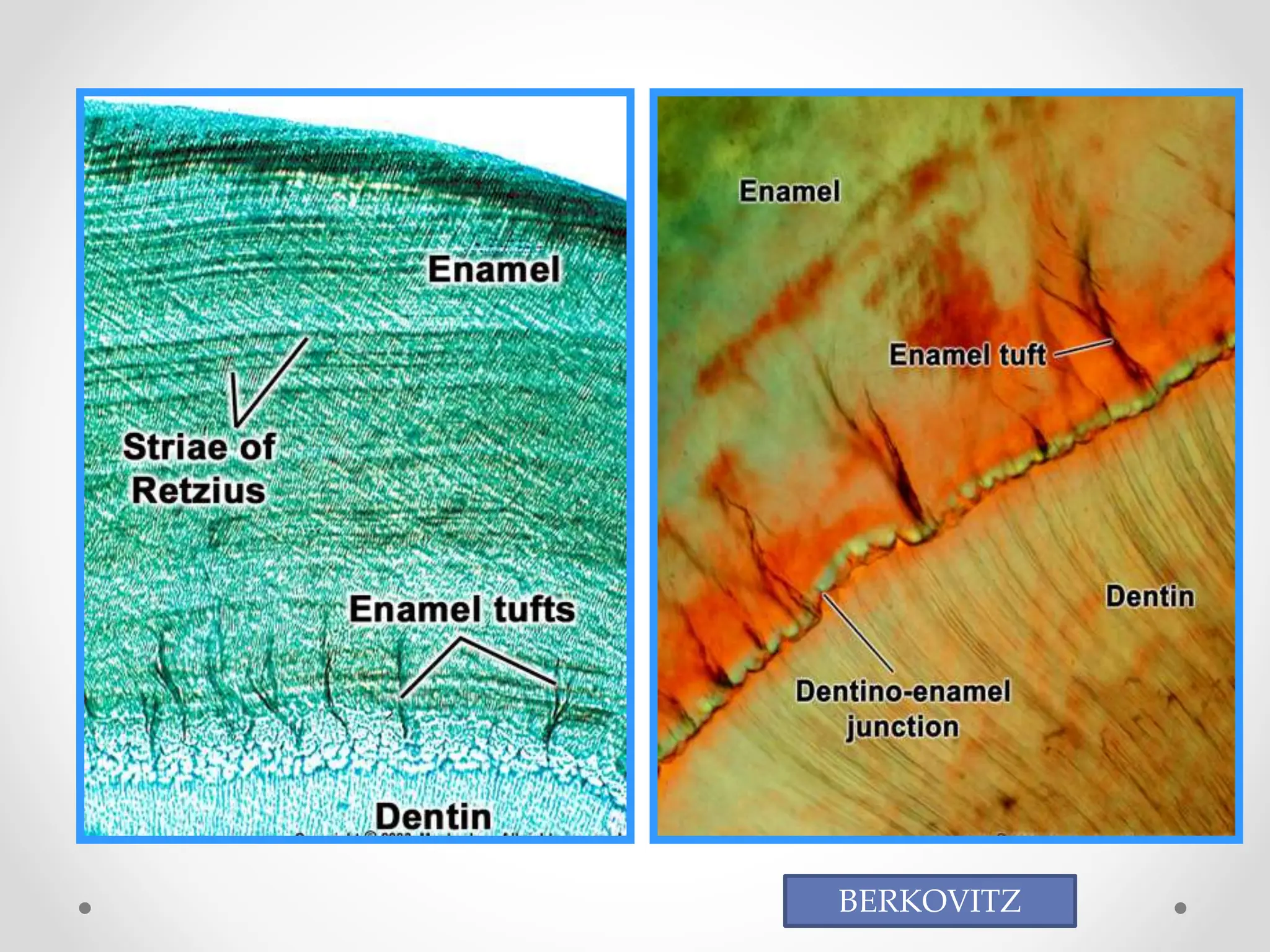 HYPOCALCIFIED STRUTURES OF ENAMEL.pptx