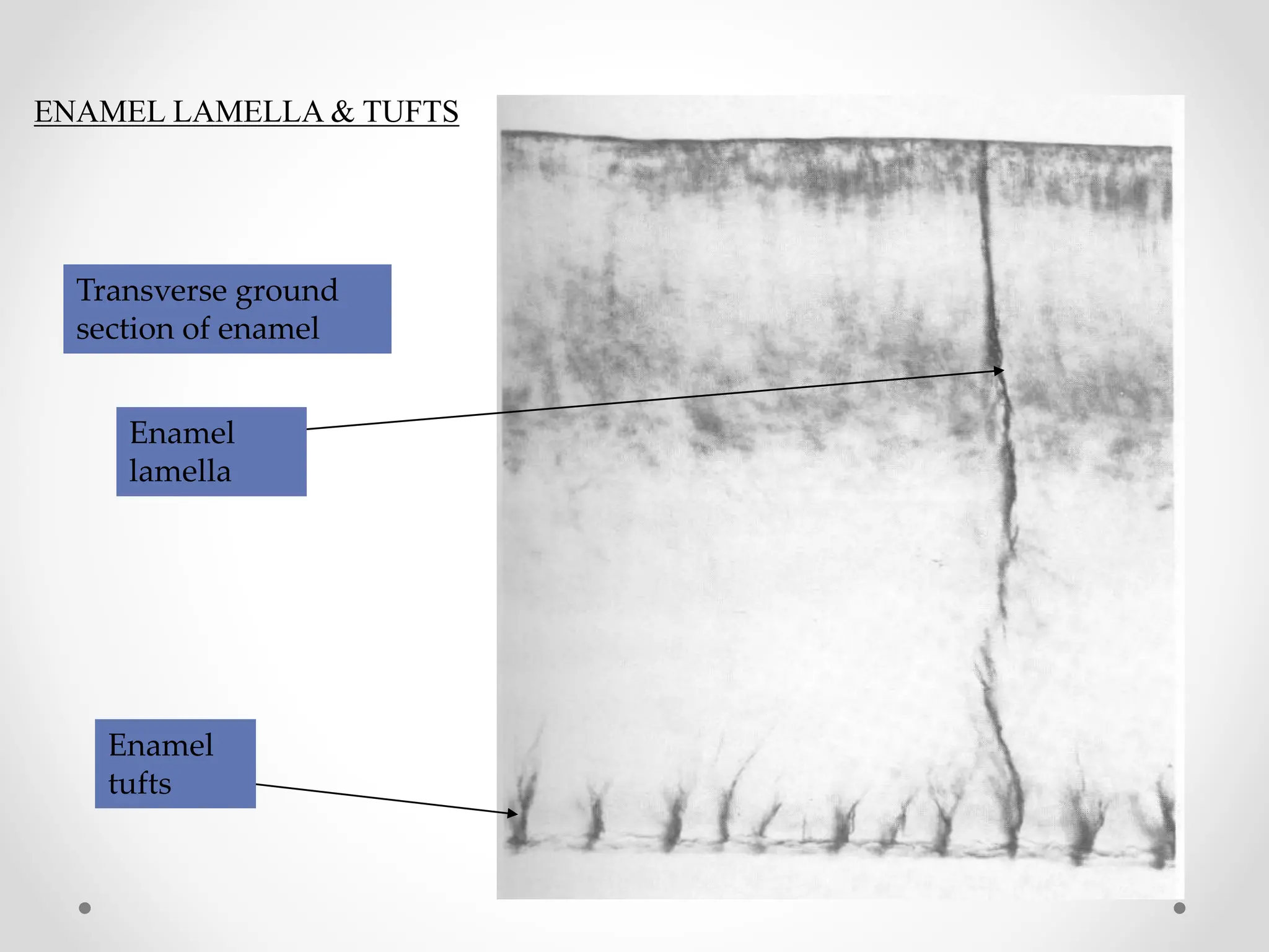 HYPOCALCIFIED STRUTURES OF ENAMEL.pptx