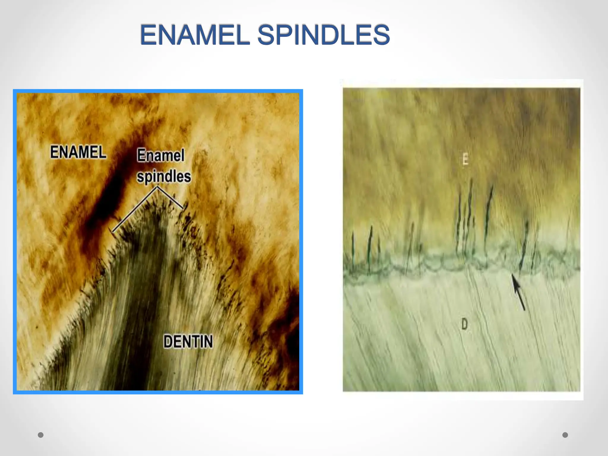 HYPOCALCIFIED STRUTURES OF ENAMEL.pptx
