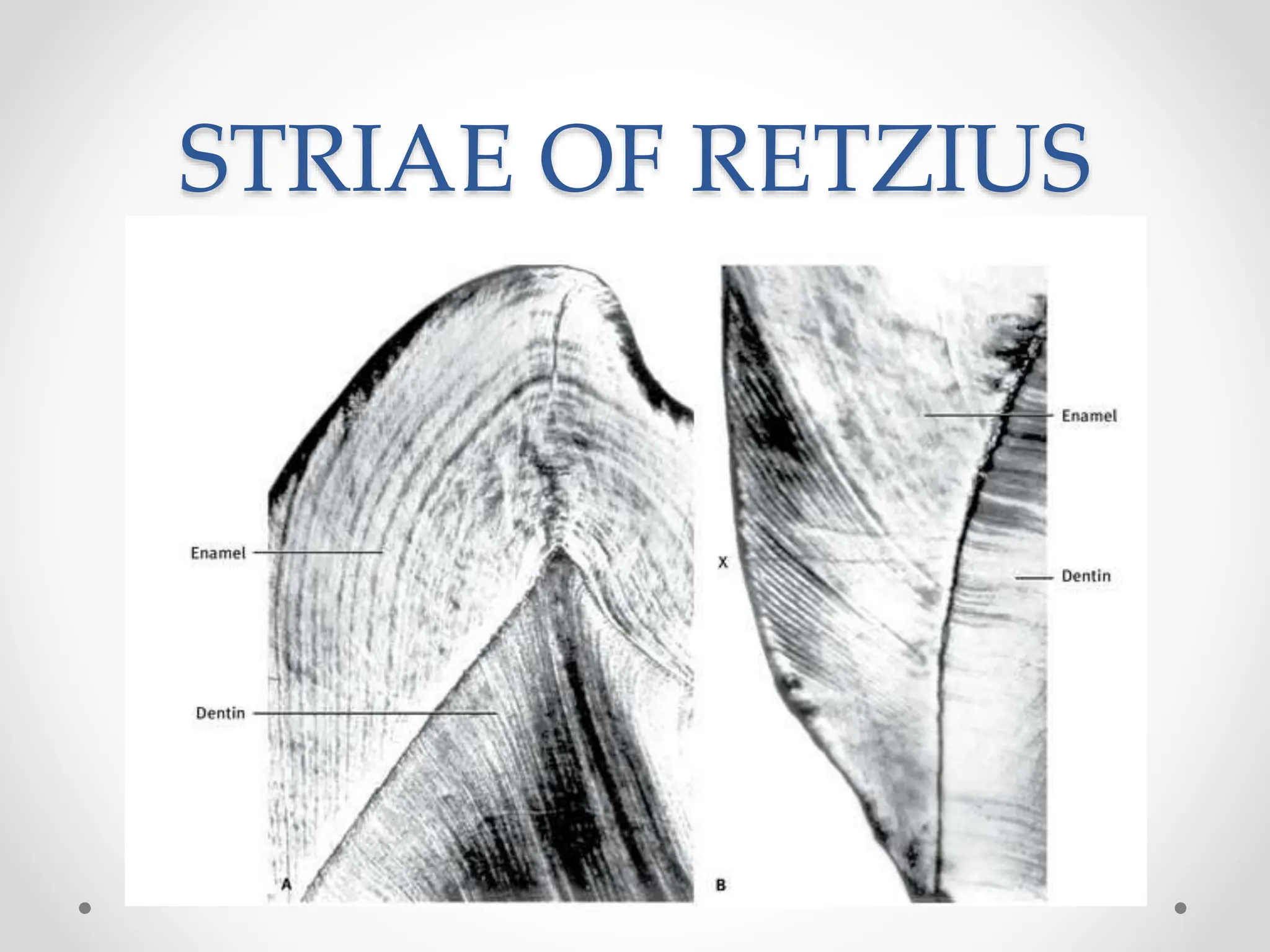 HYPOCALCIFIED STRUTURES OF ENAMEL.pptx