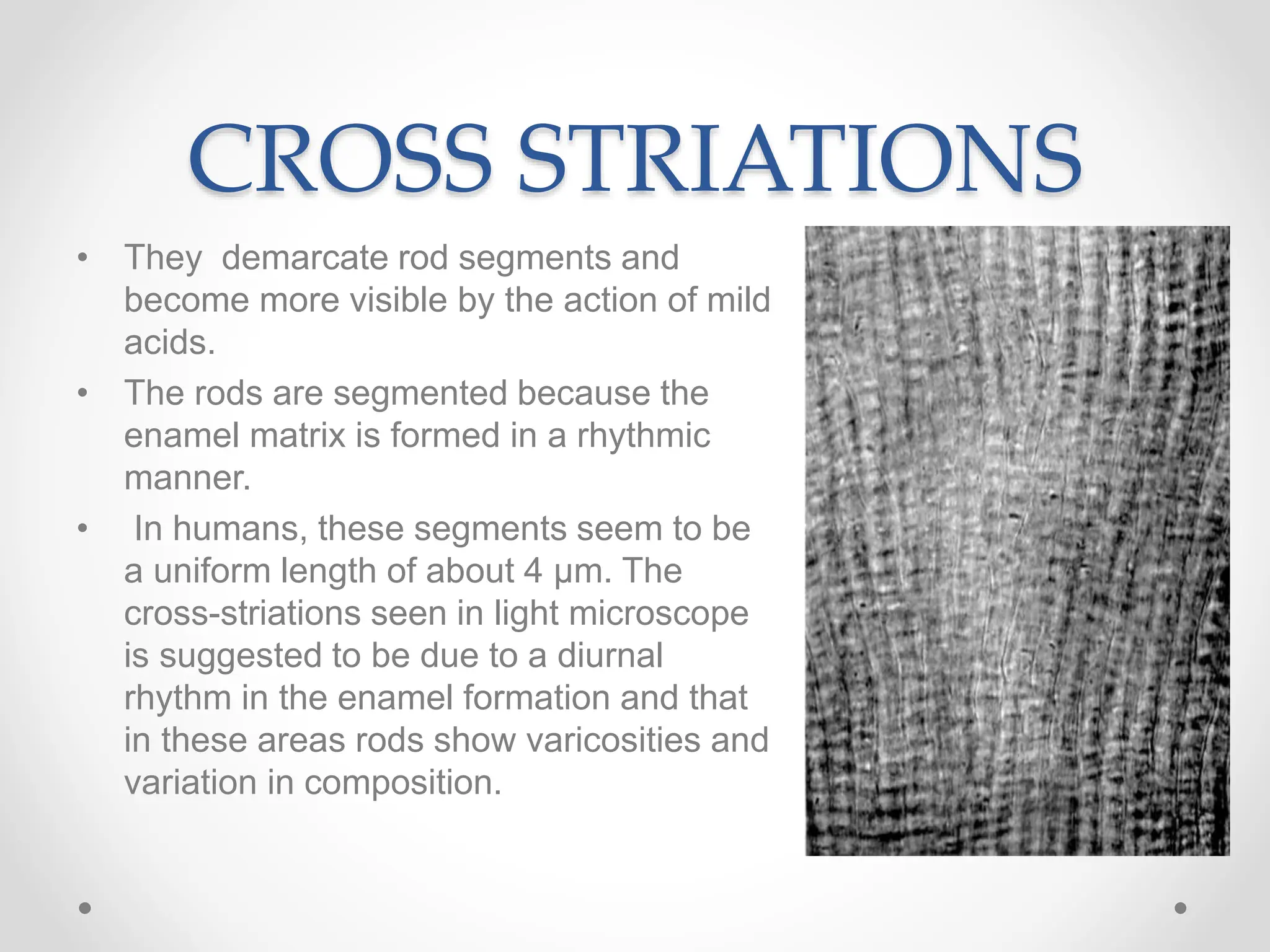 HYPOCALCIFIED STRUTURES OF ENAMEL.pptx