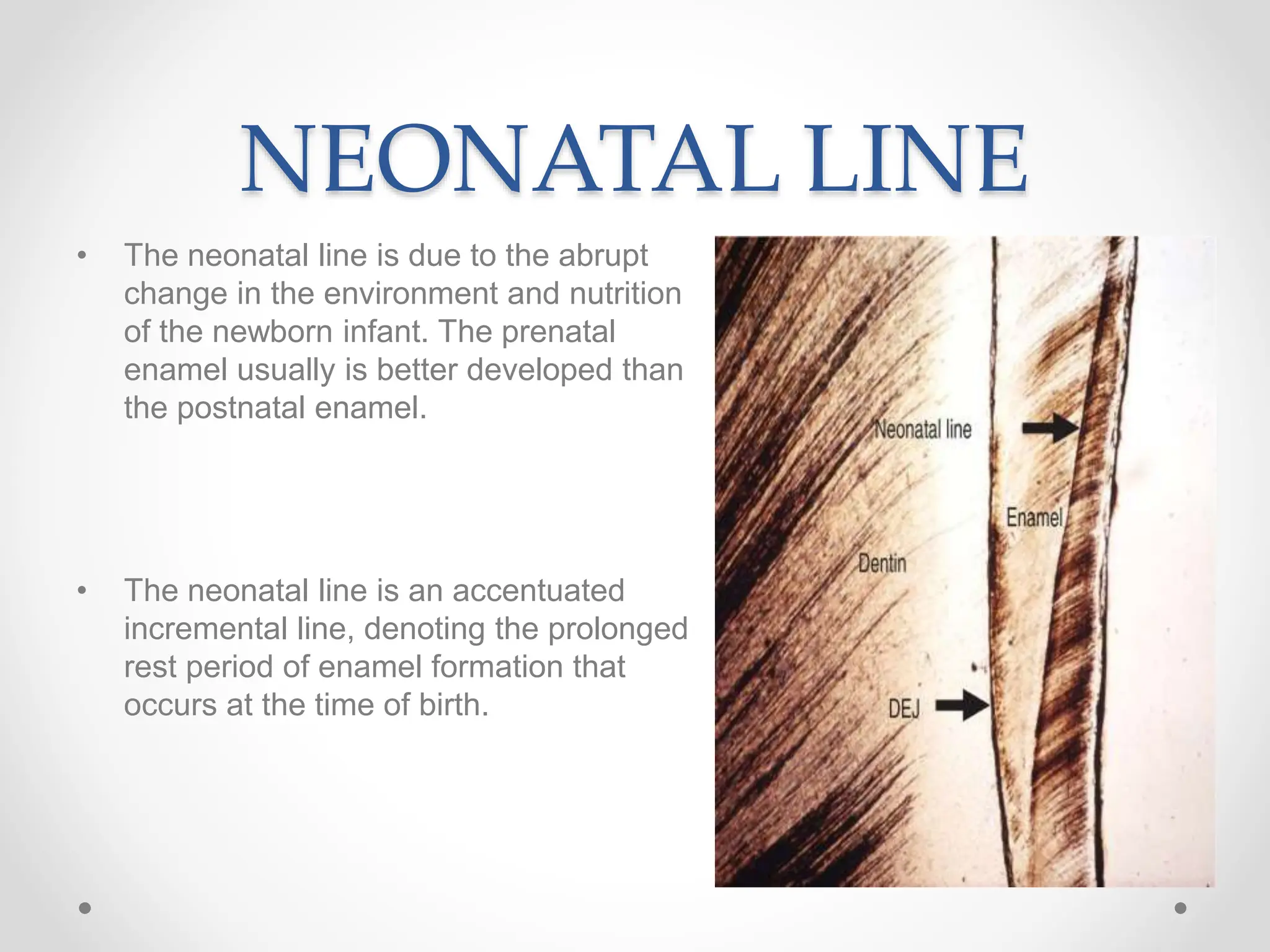 HYPOCALCIFIED STRUTURES OF ENAMEL.pptx