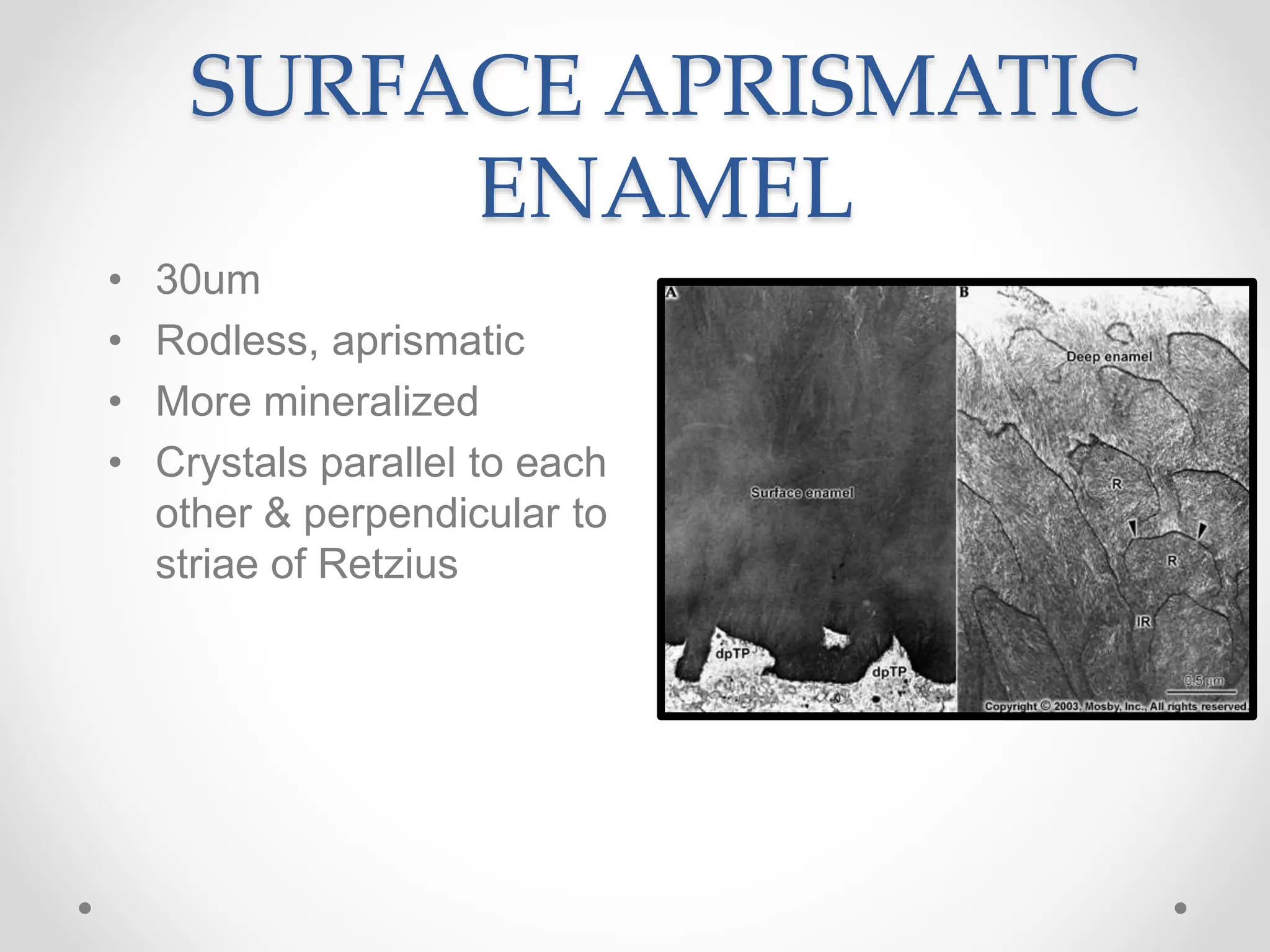 HYPOCALCIFIED STRUTURES OF ENAMEL.pptx