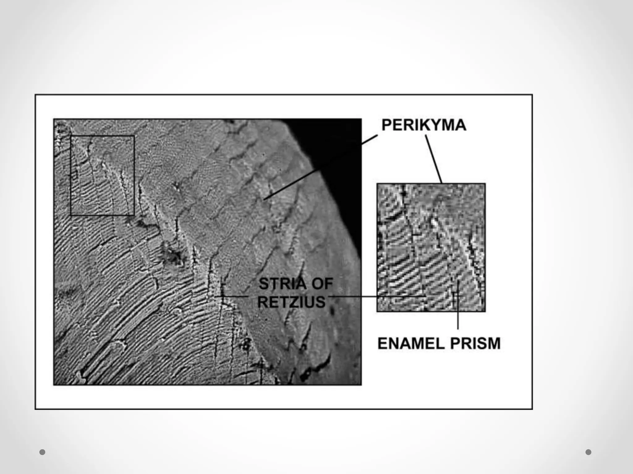 HYPOCALCIFIED STRUTURES OF ENAMEL.pptx